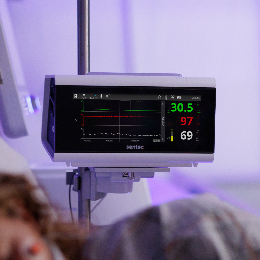 Is It Time to Reconsider Transcutaneous CO2 Monitoring for Your Unit ...