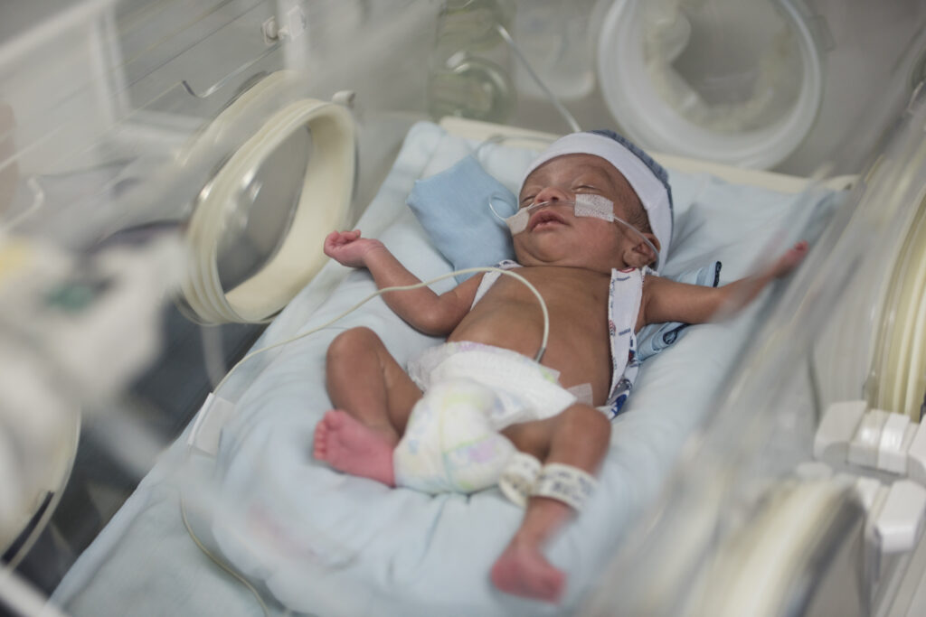 Transcutaneous CO₂ Monitoring in the NICU | Sentec