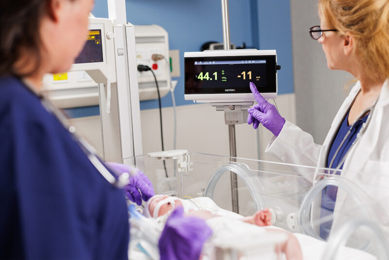Transcutaneous CO₂ Monitoring in the NICU | Sentec